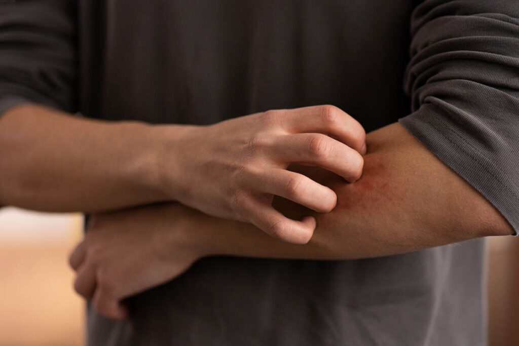 Understanding Inflammation vs Infection: Key Differences